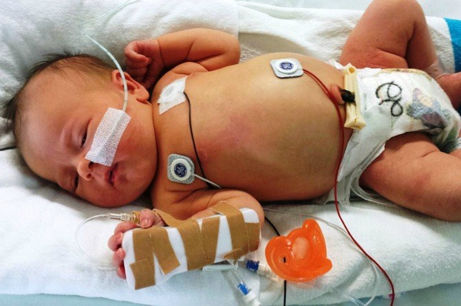 Baby Suffers Fracture After Being Thrown By His Mother's Boyfriend