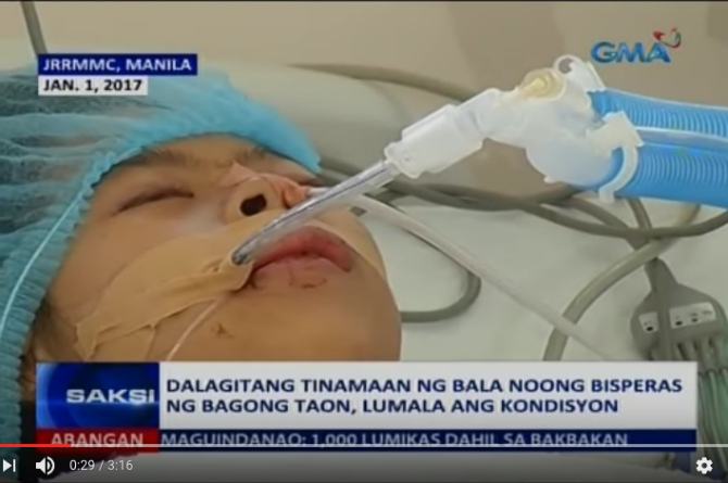 15-Year-Old Girl From Malabon Critical After Being Hit By Stray Bullet