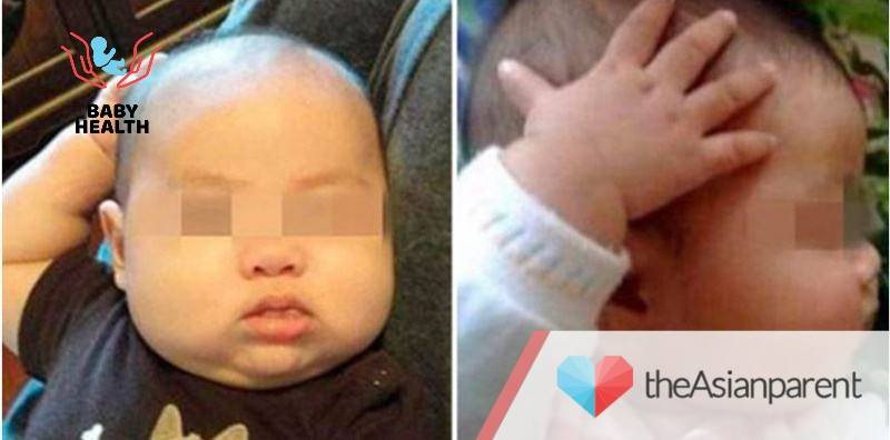 What Does It Mean When Your Baby Scratches His Head Often?