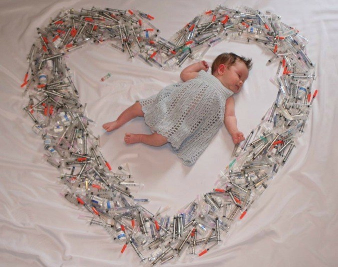 Powerful IVF Needles Image Shows What Women Go Through to Become Mums