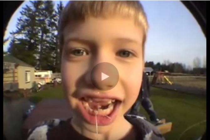 Watch: Here’s How to Pull Out A Loose Tooth with a Rocket!