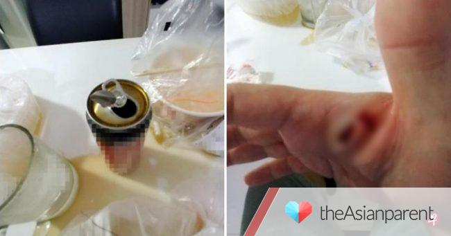 'Exploding Canned Drink' From Delivery Leaves Customer With 3 Stitches