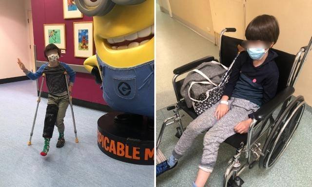 Trampoline Injuries: Boy Suffers Fractures On Knees After Fall