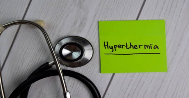 Hipertermia : Kenali Gejala, Penyebab dan Cara Pengobatannya