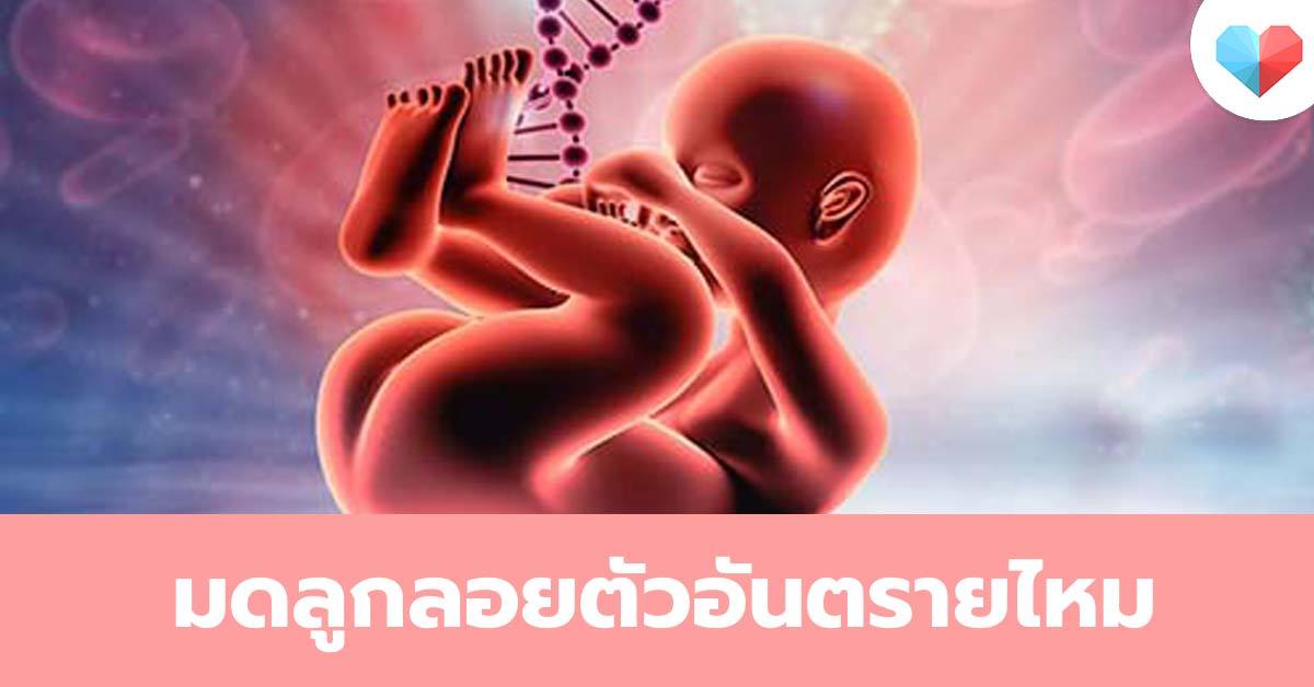 มดลูกลอยตัวอันตรายไหม มดลูกลอยตัวตอนตั้งครรภ์และหลังคลอด เป็นอย่างไร