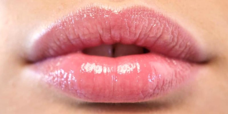 Dark Spots On Lips Herpes | Lipstutorial.org