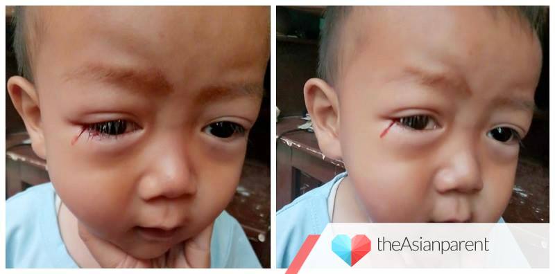 Menangis Darah Kerana Sering Guna Telefon Bimbit - Betul Ke?